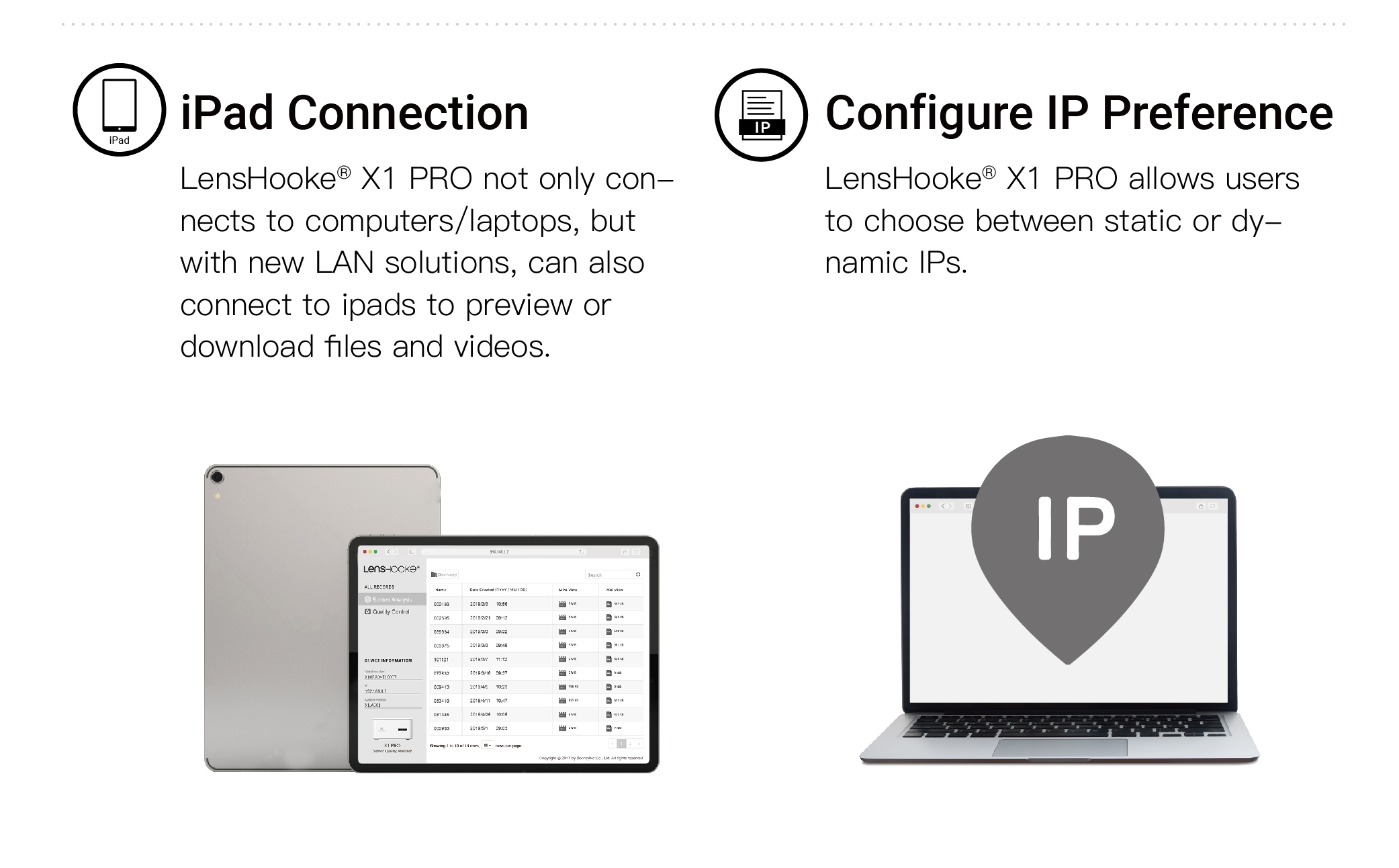 LensHooke X1 PRO Semen Quality Analyzer - LensHooke